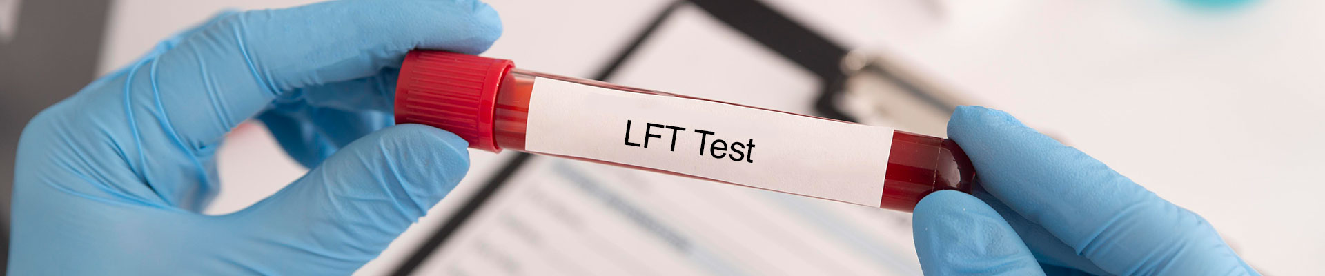 Understanding the Basics of Liver Function Tests | HOD
